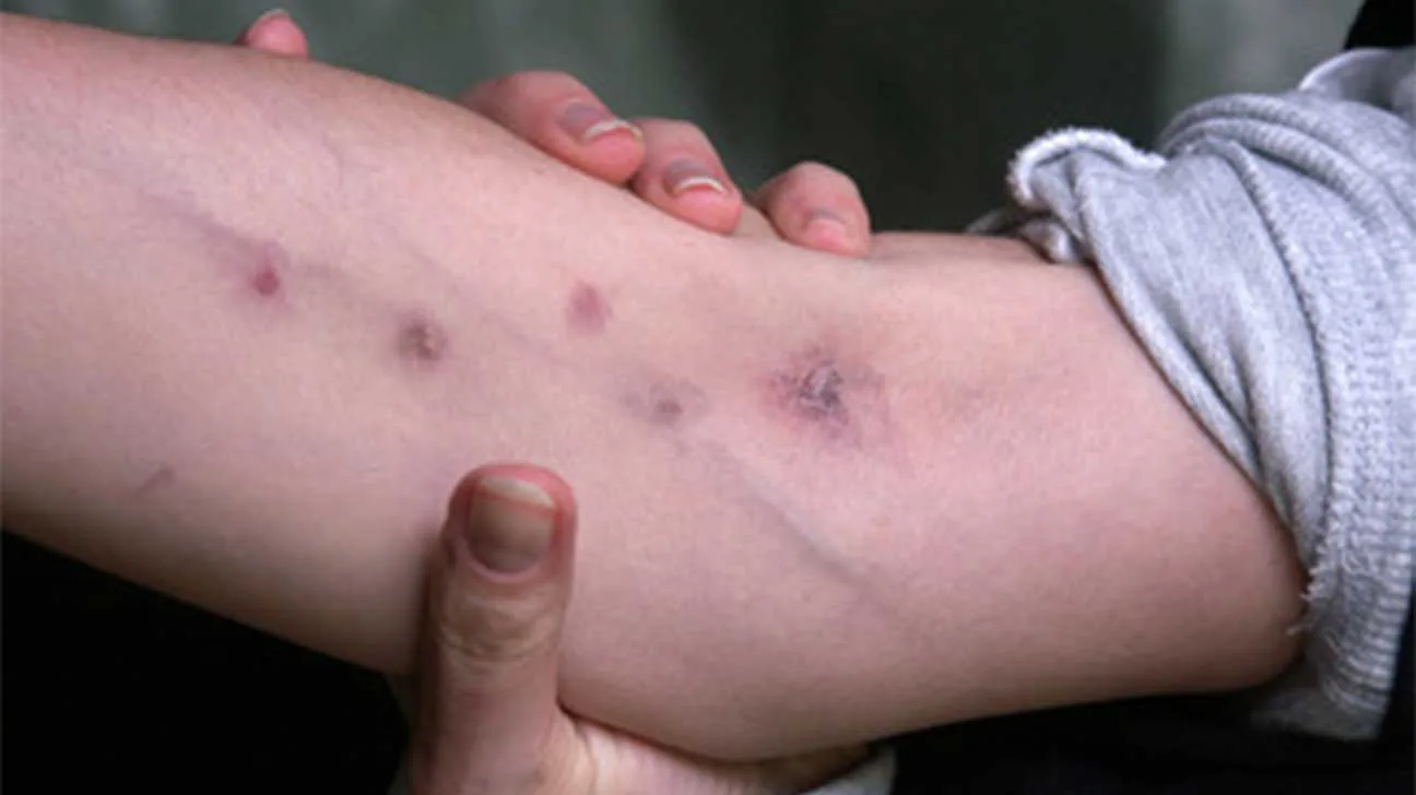 Reconnaître les yeux d'une personne droguée : les signes